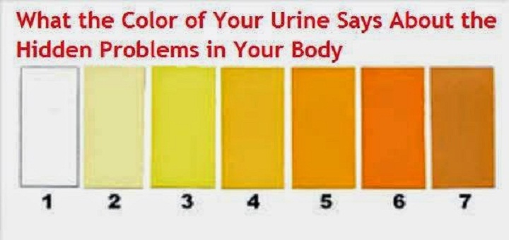 Color of Urine says about your health