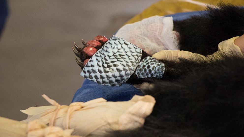 How using fish skin to heal burn wounds actually works