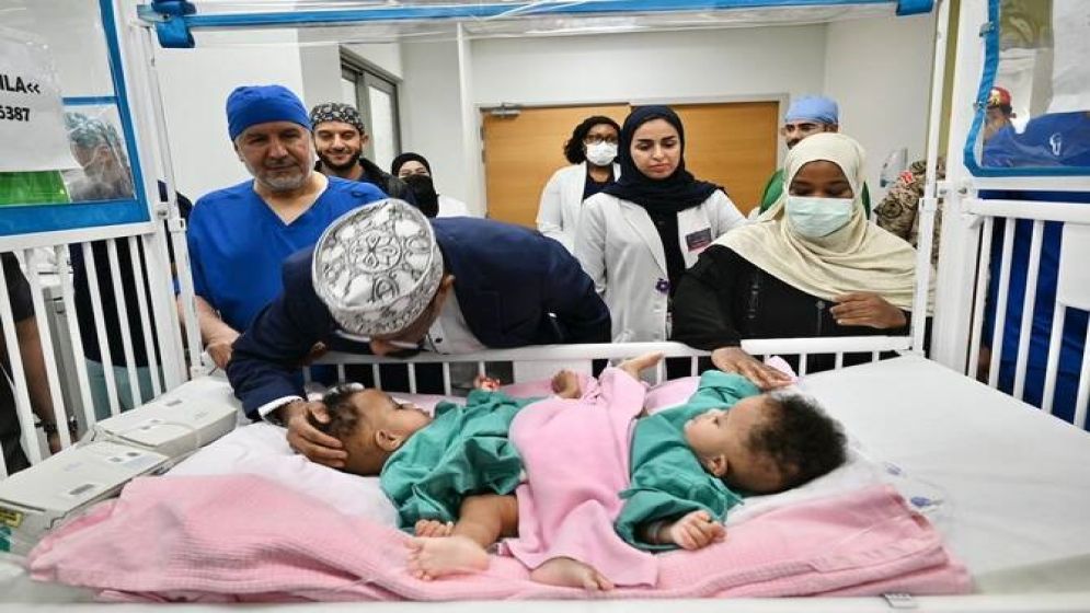 Somali conjoined twins Rahma and Ramla ‘successfully separated’ in Riyadh