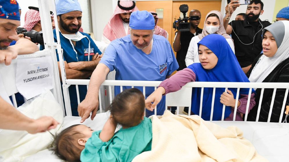 Filipino conjoined twins separated after 6-hour surgery in Riyadh